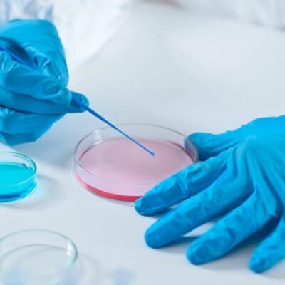 ΑΝΑΔΙΩΤΗΣ ΛΟΥΚΑΣ ΜΙΚΡΟΒΙΟΛΟΓΙΚΟ ΕΡΓΑΣΤΗΡΙΟ ΘΗΒΑ ΒΟΙΩΤΙΑΣ